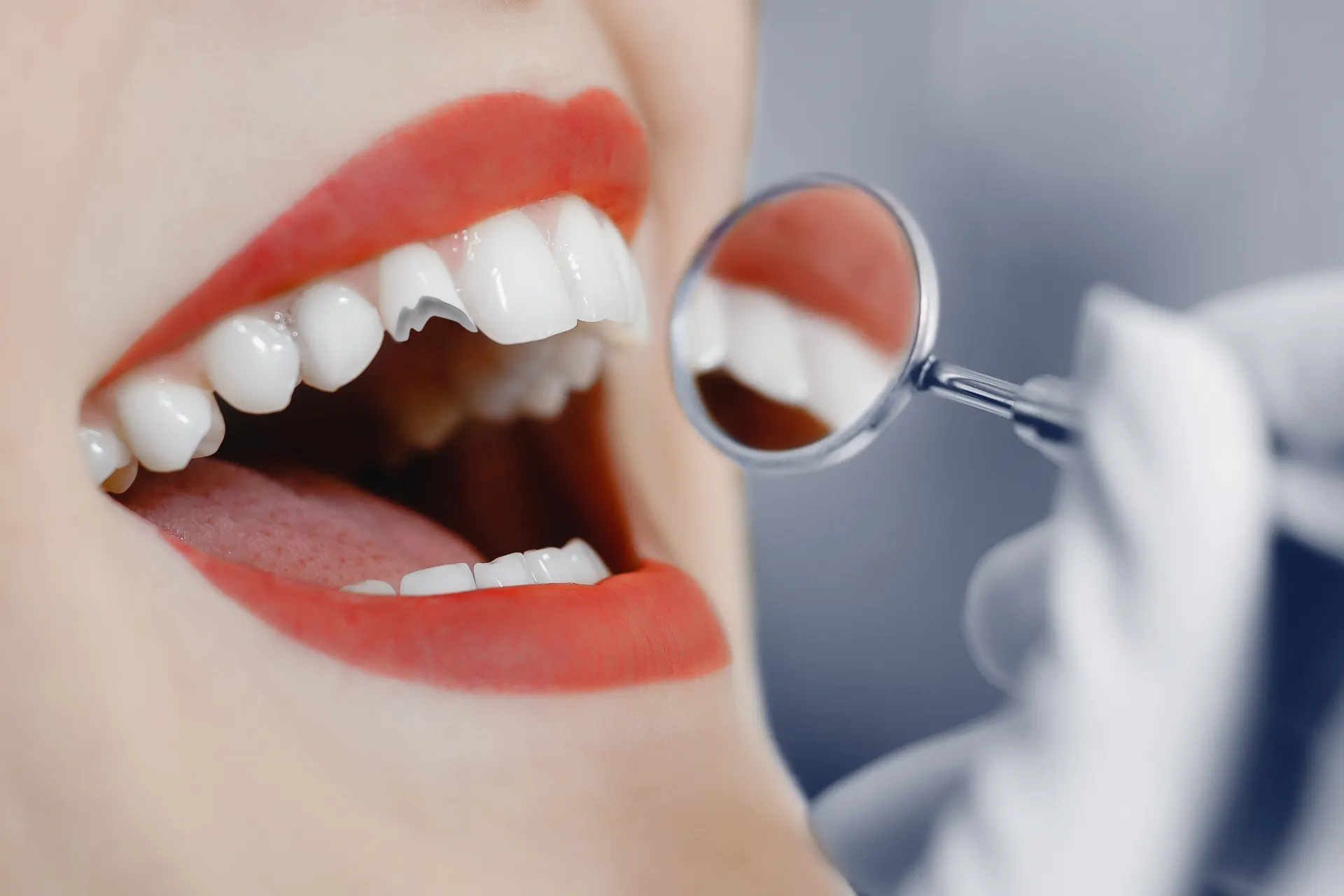 Broken Tooth Extraction in Houston: Everything You Need to Know | Hanna ...