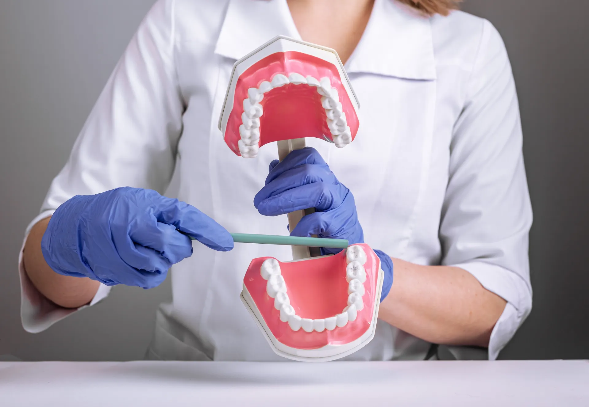 Wisdom Teeth Removal in Houston | Hanna Dental Implant Center