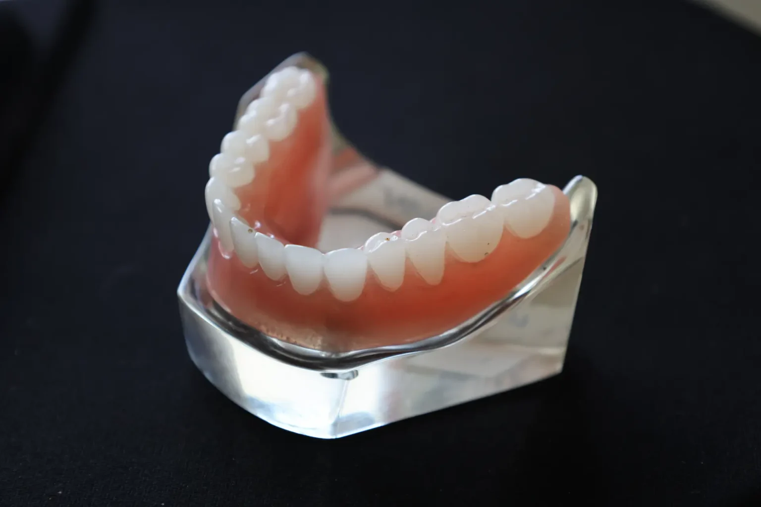 What Do Dental Implants Look Like? Complete Visual Guide & Comparison ...