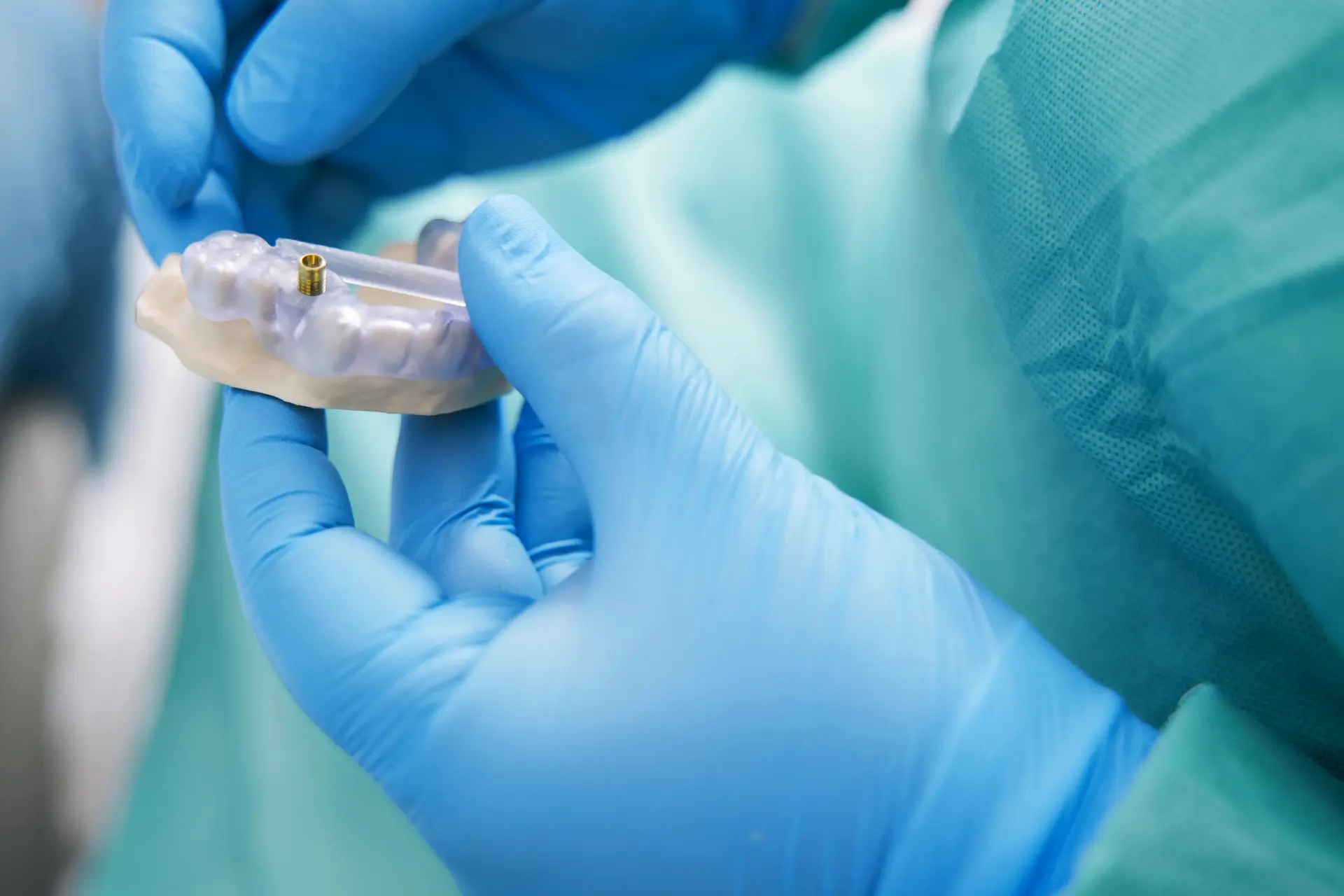 Top Solutions for a Missing Front Tooth | Hanna Dental Implant Center